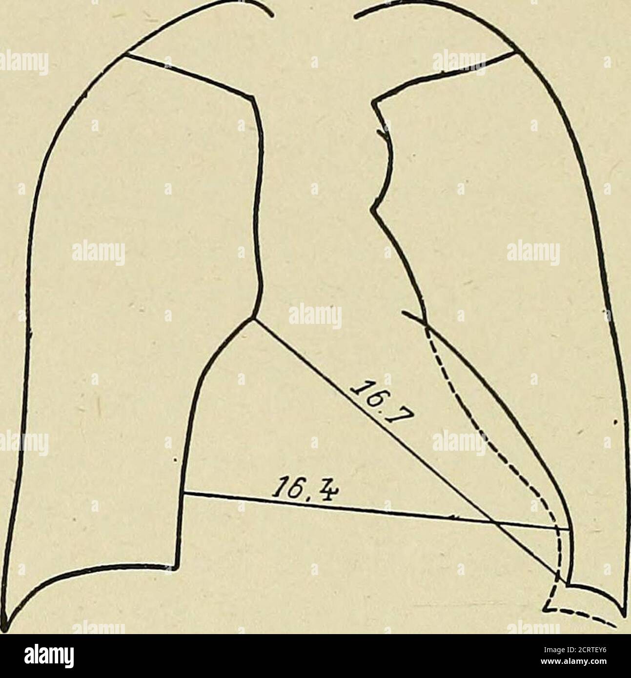 Flaccidity hi-res stock photography and images - Alamy