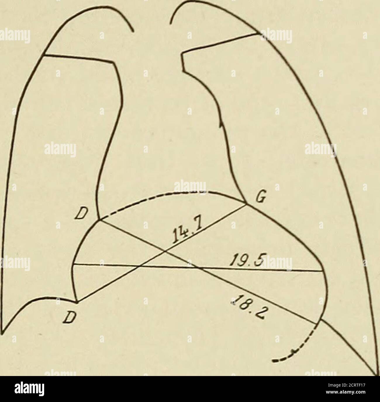 . The heart and the aorta; studies in clinical radiology . ed, it is ...