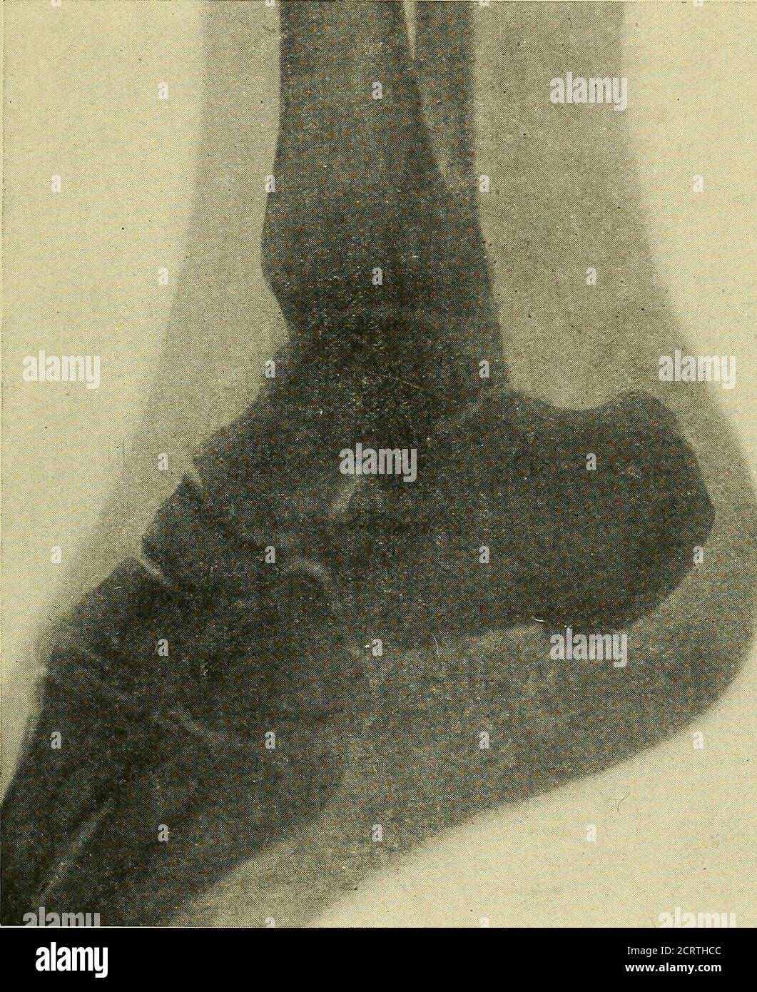 Fluoroscope hand hi-res stock photography and images - Alamy