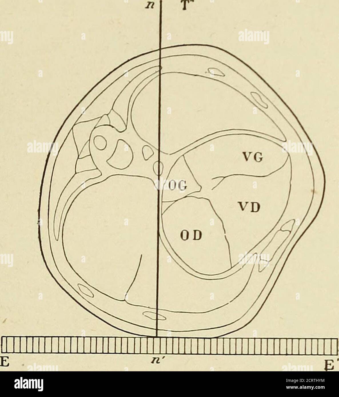 . The heart and the aorta; studies in clinical radiology . Fig. 19 ...