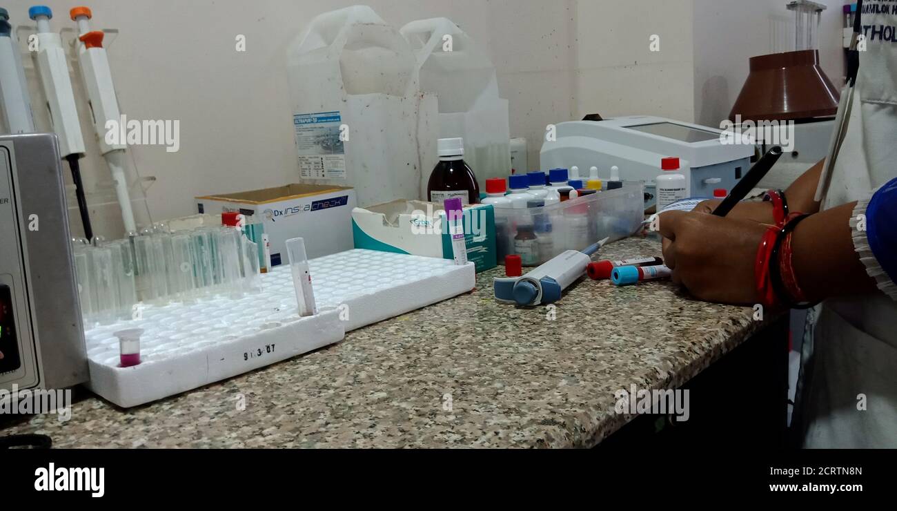 DISTRICT KATNI, INDIA - SEPTEMBER 28, 2019: Pathology laboratory tools ...