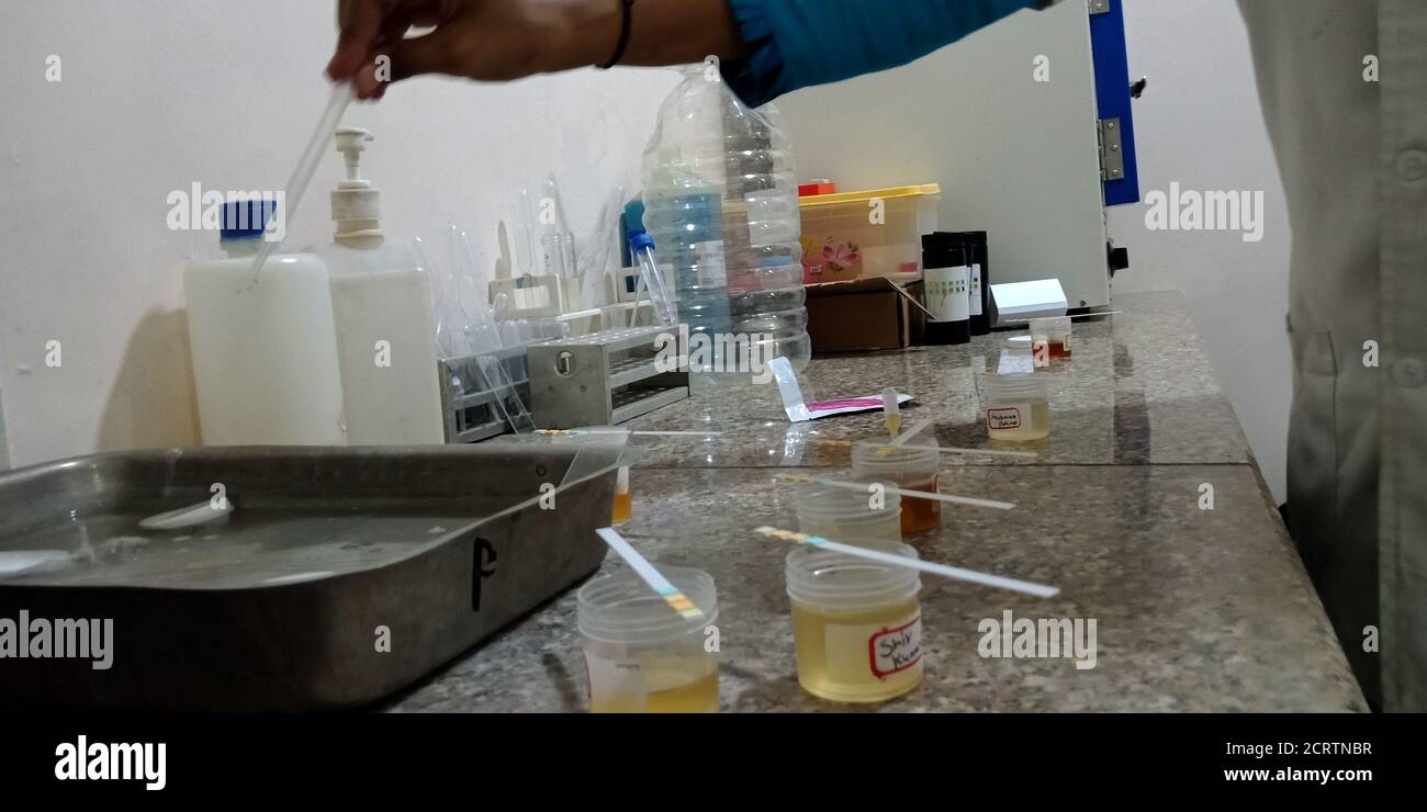 DISTRICT KATNI, INDIA - SEPTEMBER 28, 2019: Urine sample kept at ...