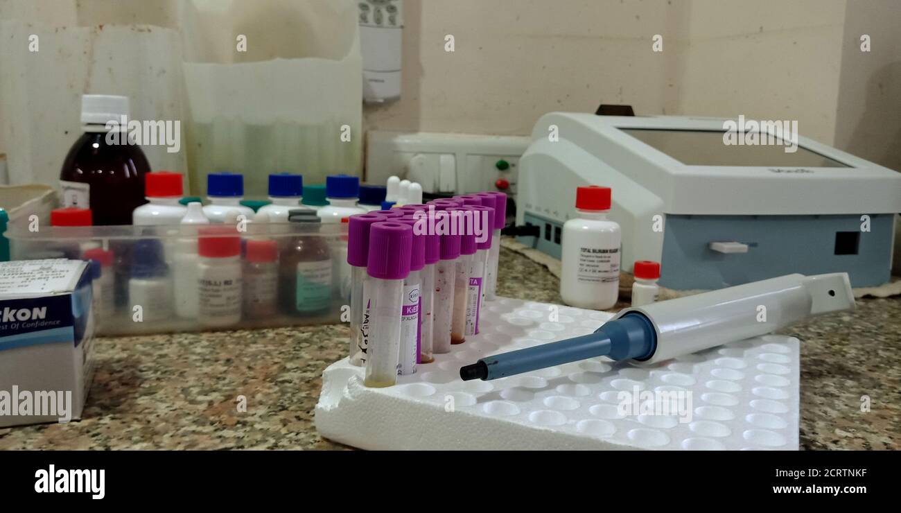 DISTRICT KATNI, INDIA - SEPTEMBER 28, 2019: Urine sample kept at ...