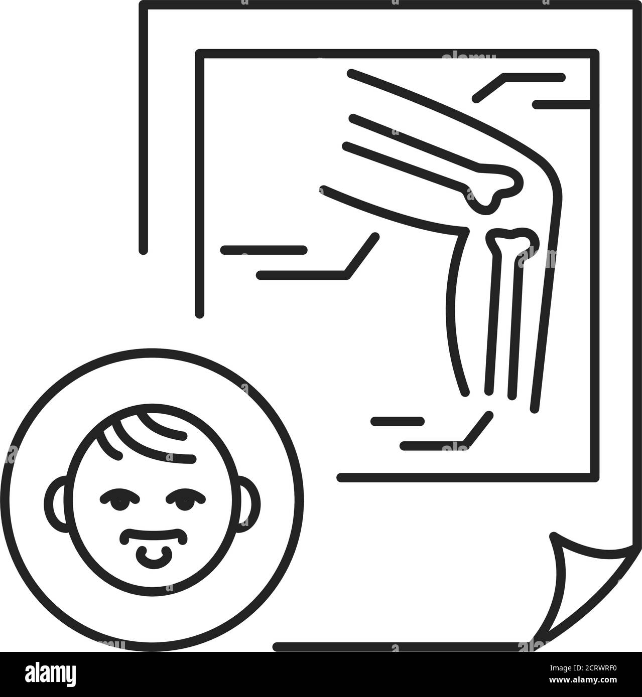 Pediatric orthopedics black line icon. Check and treatment in fracture ...