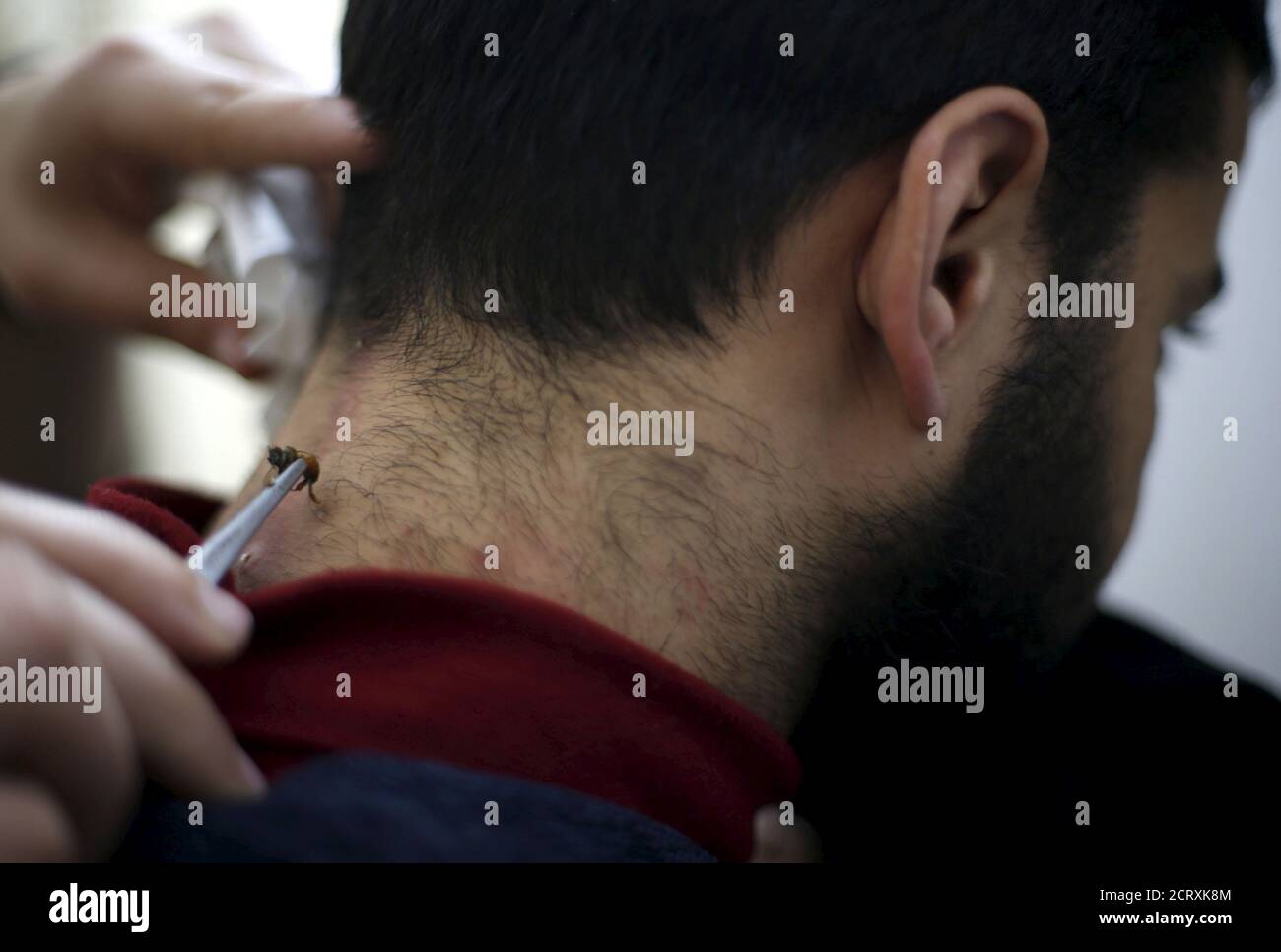 Man and bee sting hi-res stock photography and images - Alamy