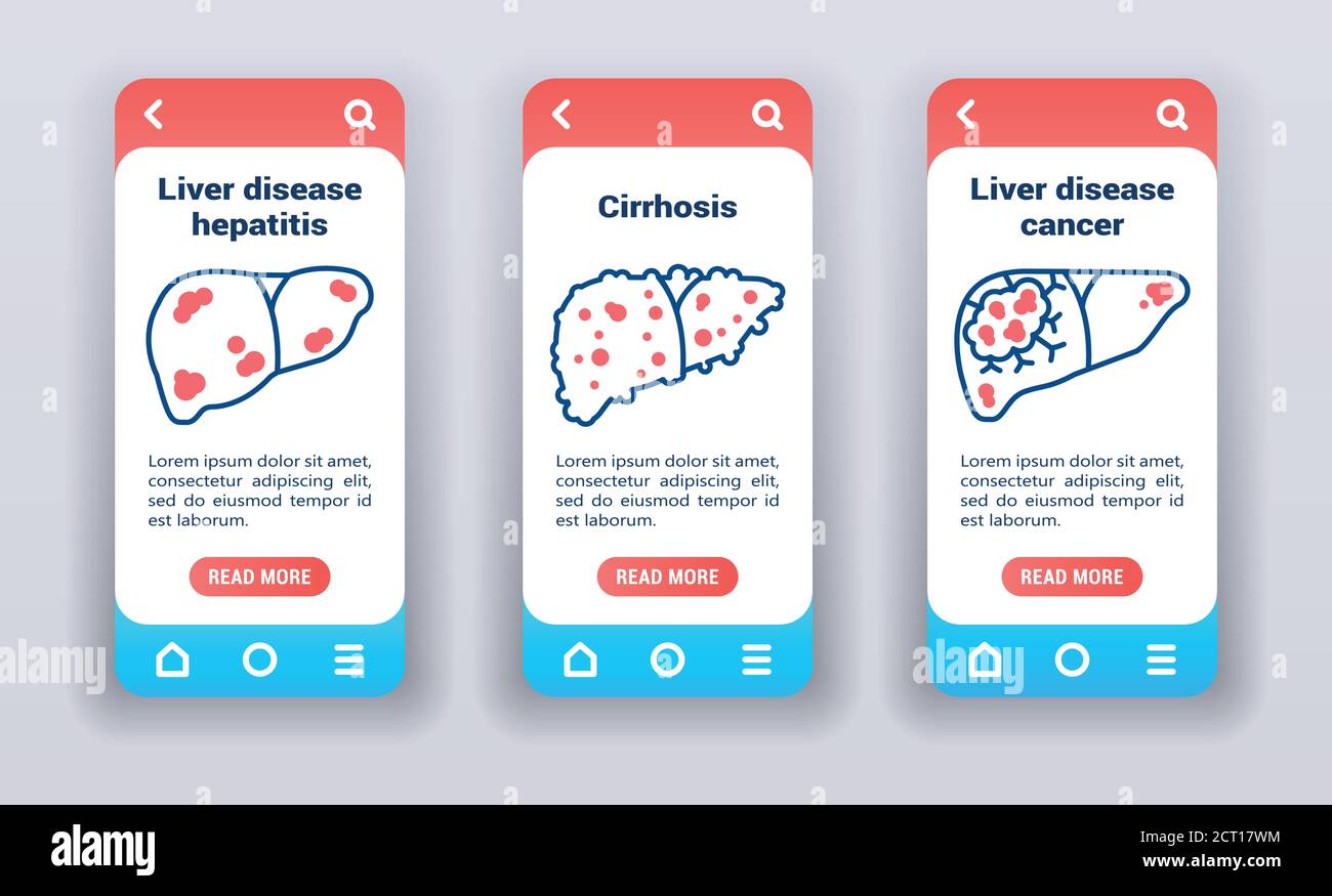 Liver disease on mobile app onboarding screens Stock Vector Image & Art - Alamy