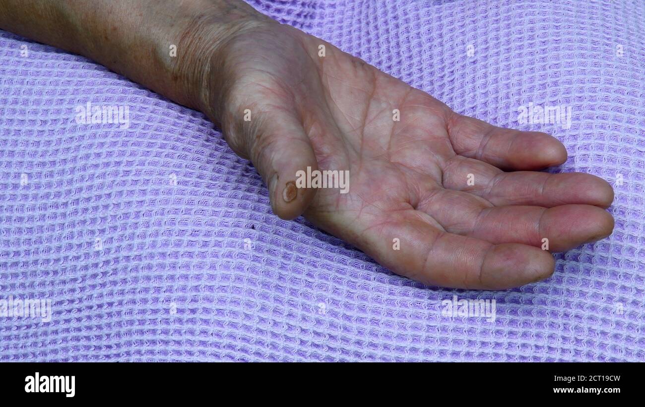 Closeup of opened palm hand of senior woman of 80 year old. Mature skin ...