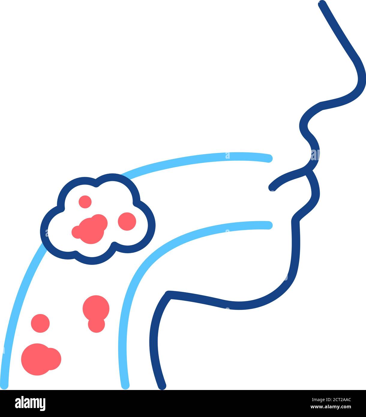 Laryngeal cancer line color icon. Human organ concept. Malignant ...