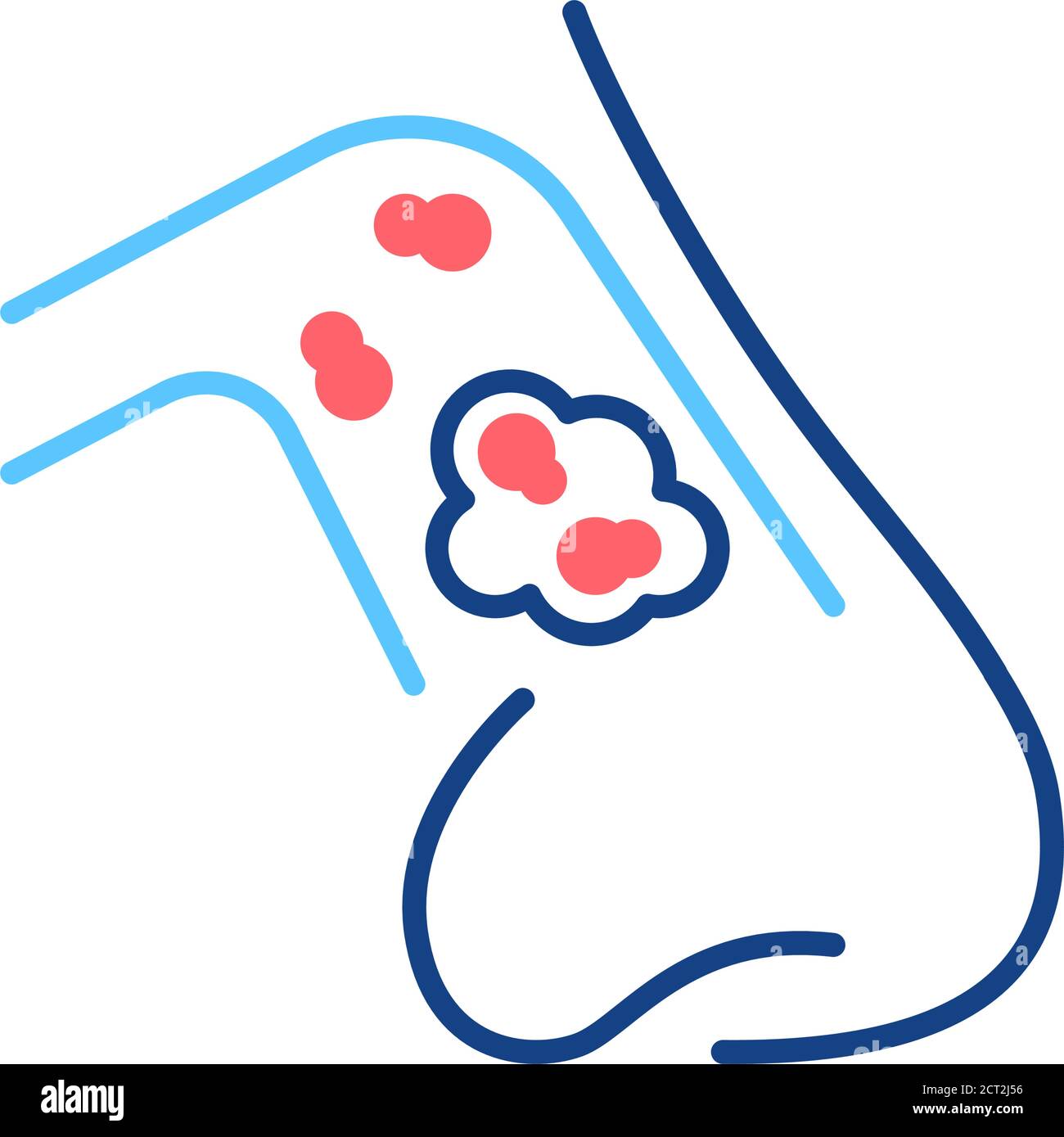 Nose cancer line color icon. Human organ concept. Malignant neoplasm ...