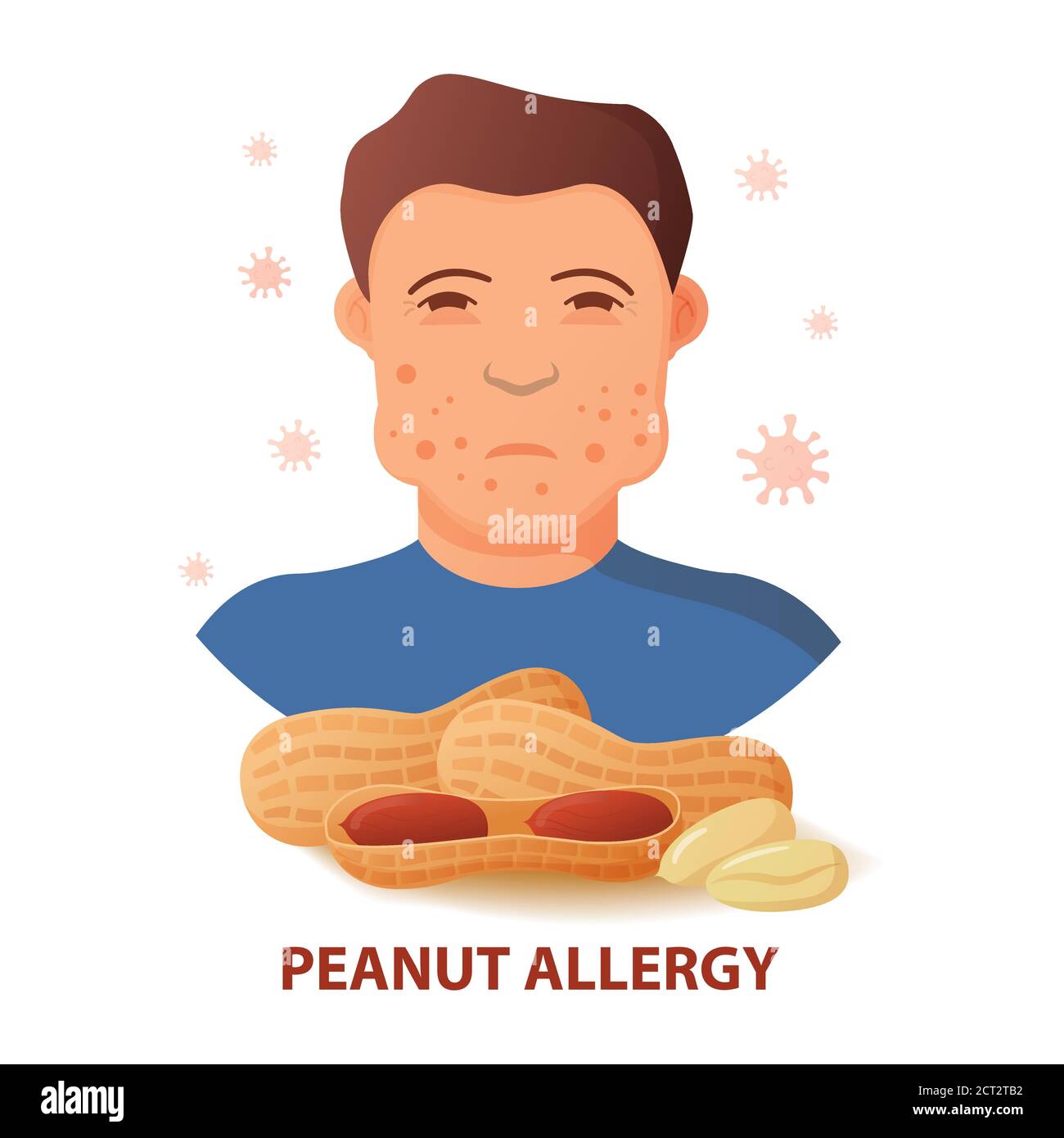 Nut allergy symptoms problem .Swollen man character.Anaphylaxis person ...
