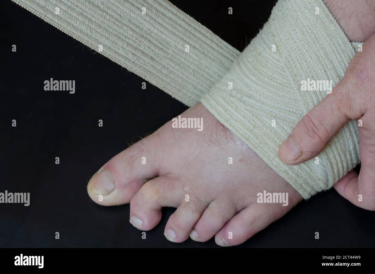 Middle-aged Caucasian man produces an independent bandage of his ...