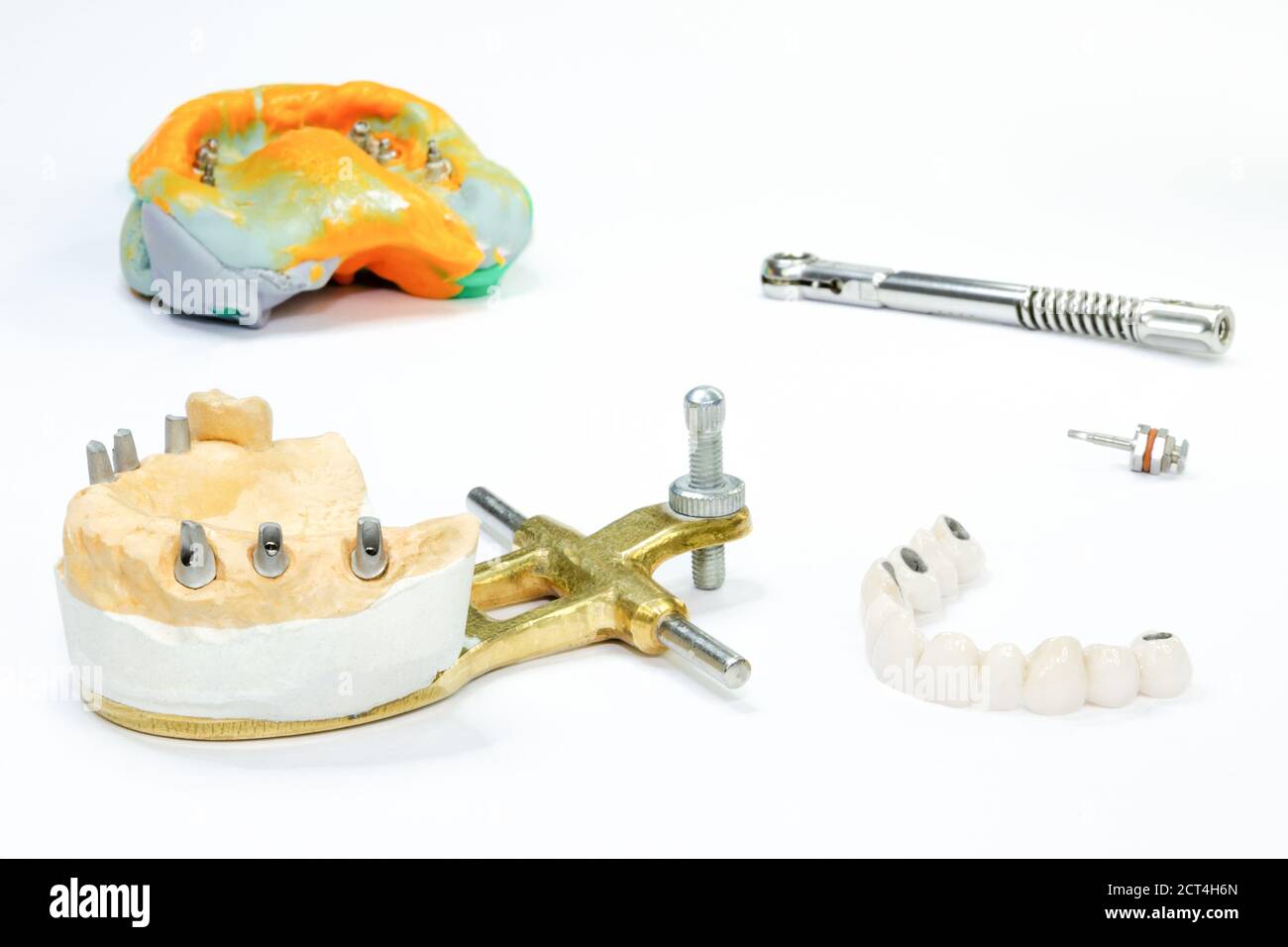 jaw model with dental implants and ceramic crowns. in the background is ...