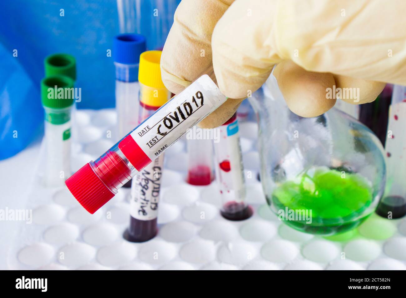 Covid - 19 and corona virus blood test sample, negative and positive ...