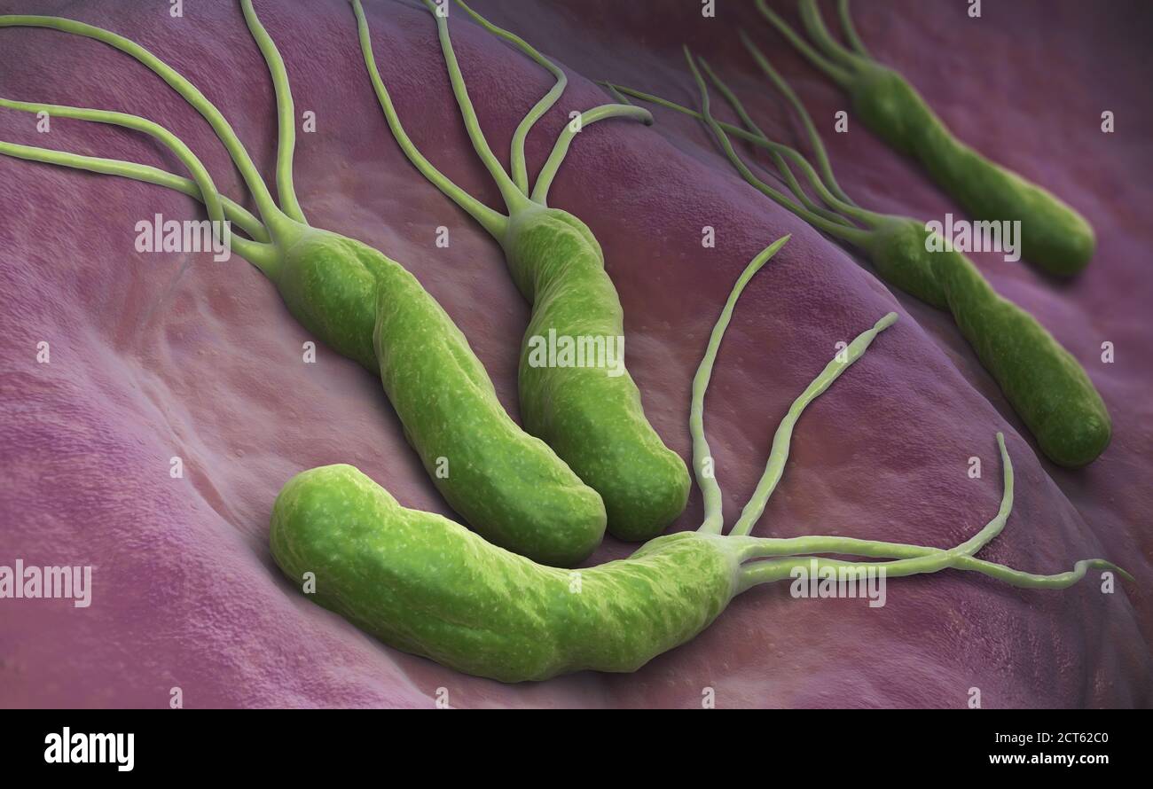 Helicobacter pylori hi-res stock photography and images - Alamy