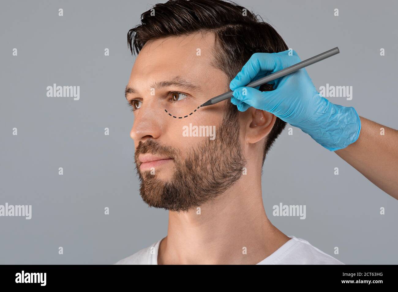 Man face surgery marks hi-res stock photography and images - Alamy