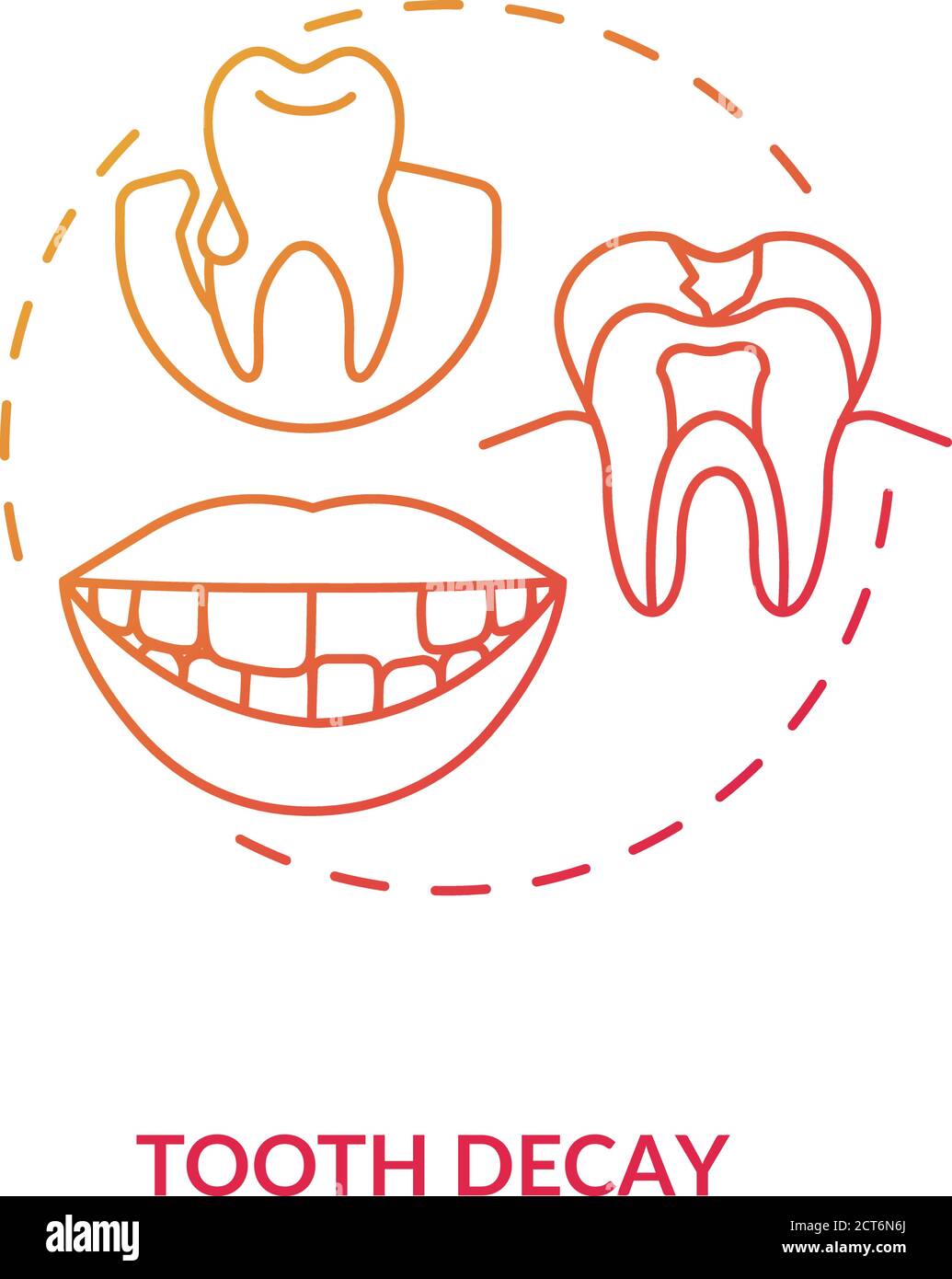Tooth decay concept icon Stock Vector Image & Art - Alamy