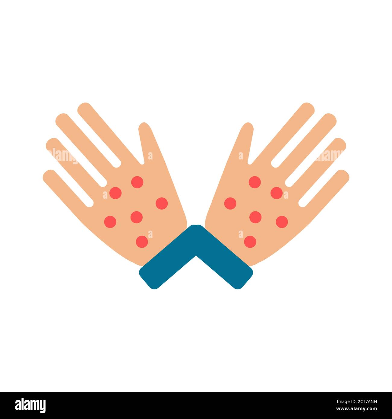 Rash icon. Simple element from allergy collection. Creative Rash icon ...