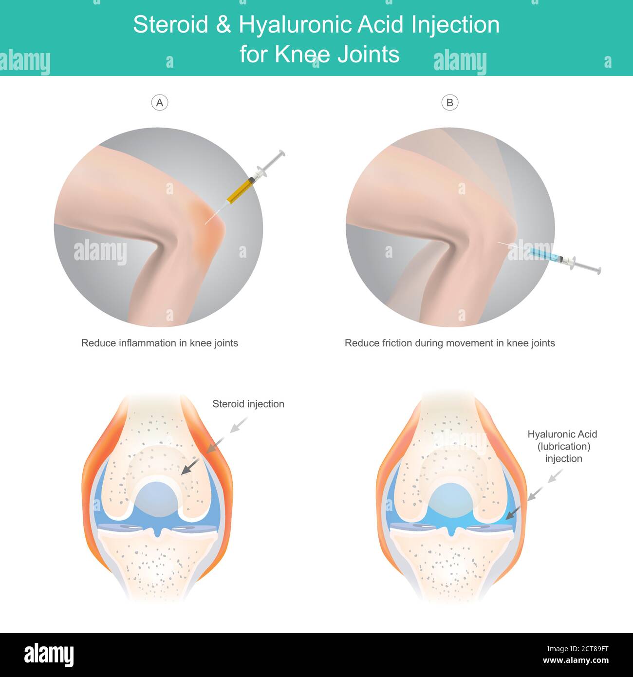 Symptoms treat Stock Vector Images - Alamy