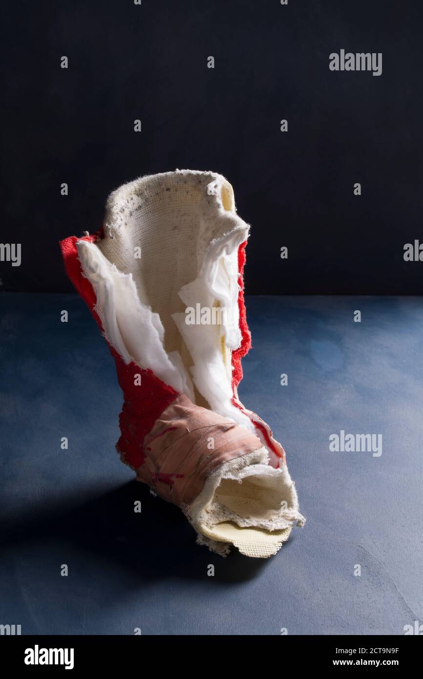 Leg fracture plaster hi-res stock photography and images - Alamy