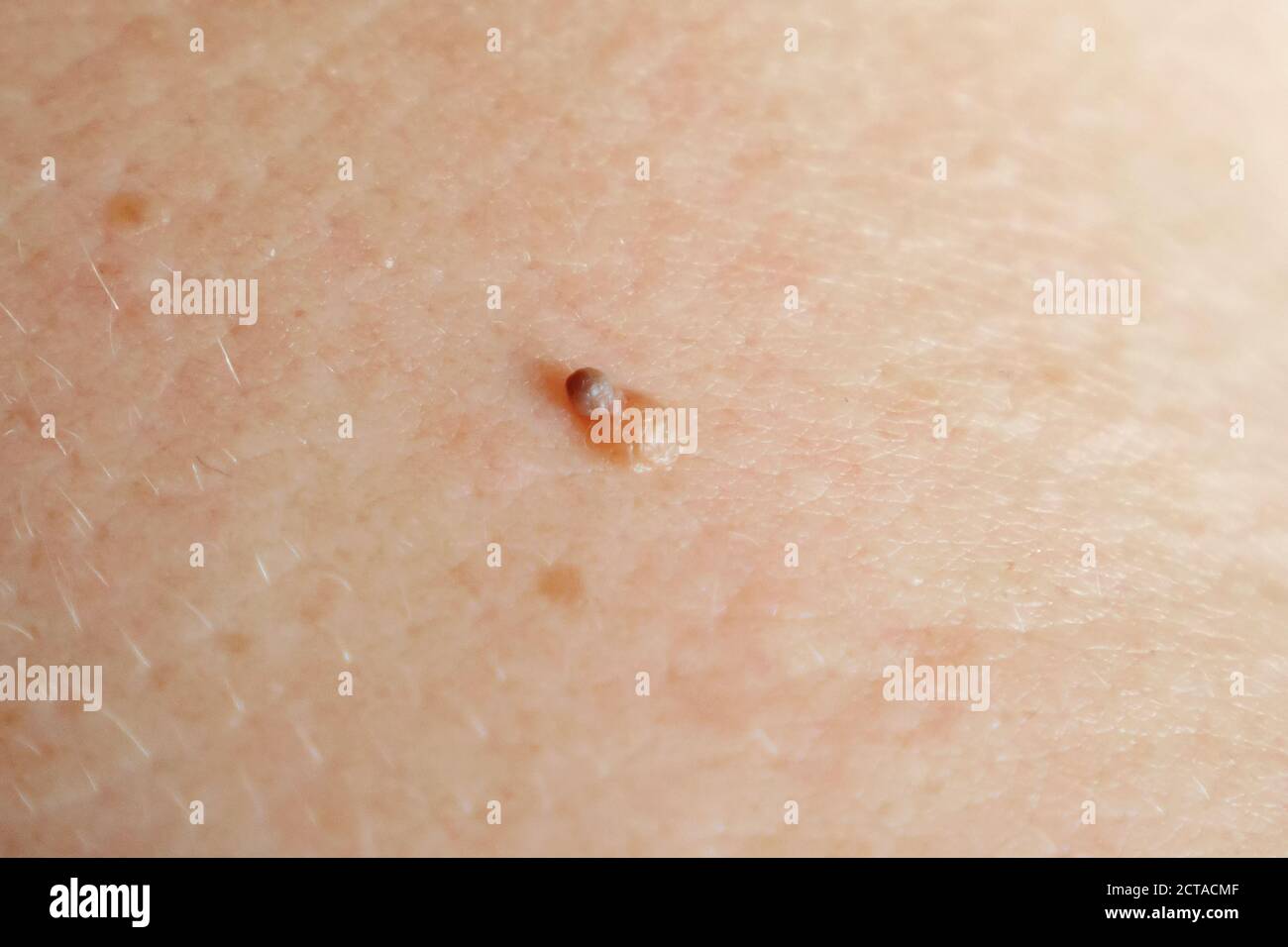 Outer mole hi-res stock photography and images - Alamy