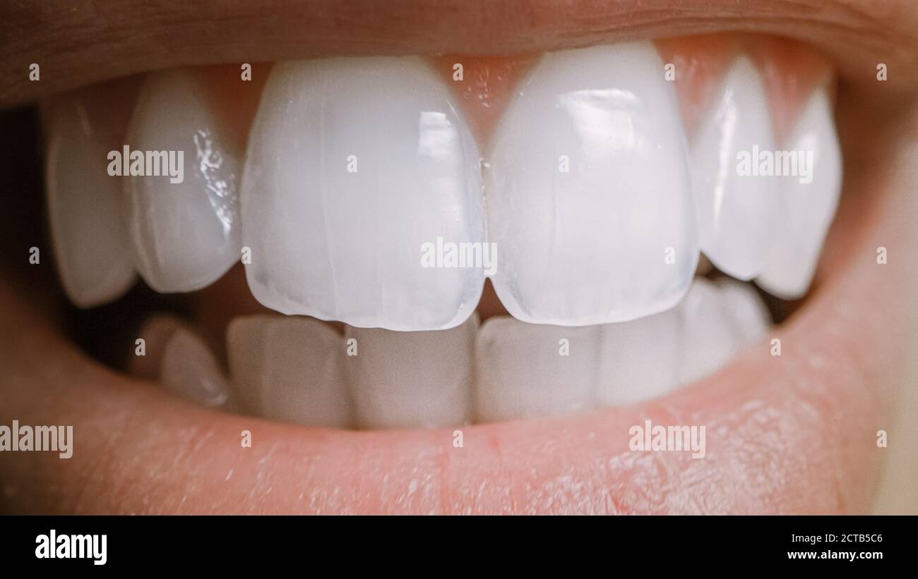Close Up Macro Shot of a Mouth with Perfect White Teeth. Person Smiles ...