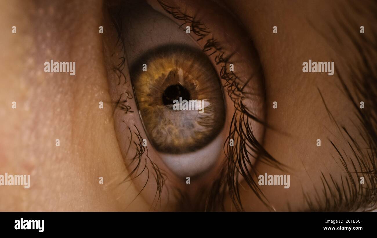 Eyes pigmentation hi-res stock photography and images - Alamy