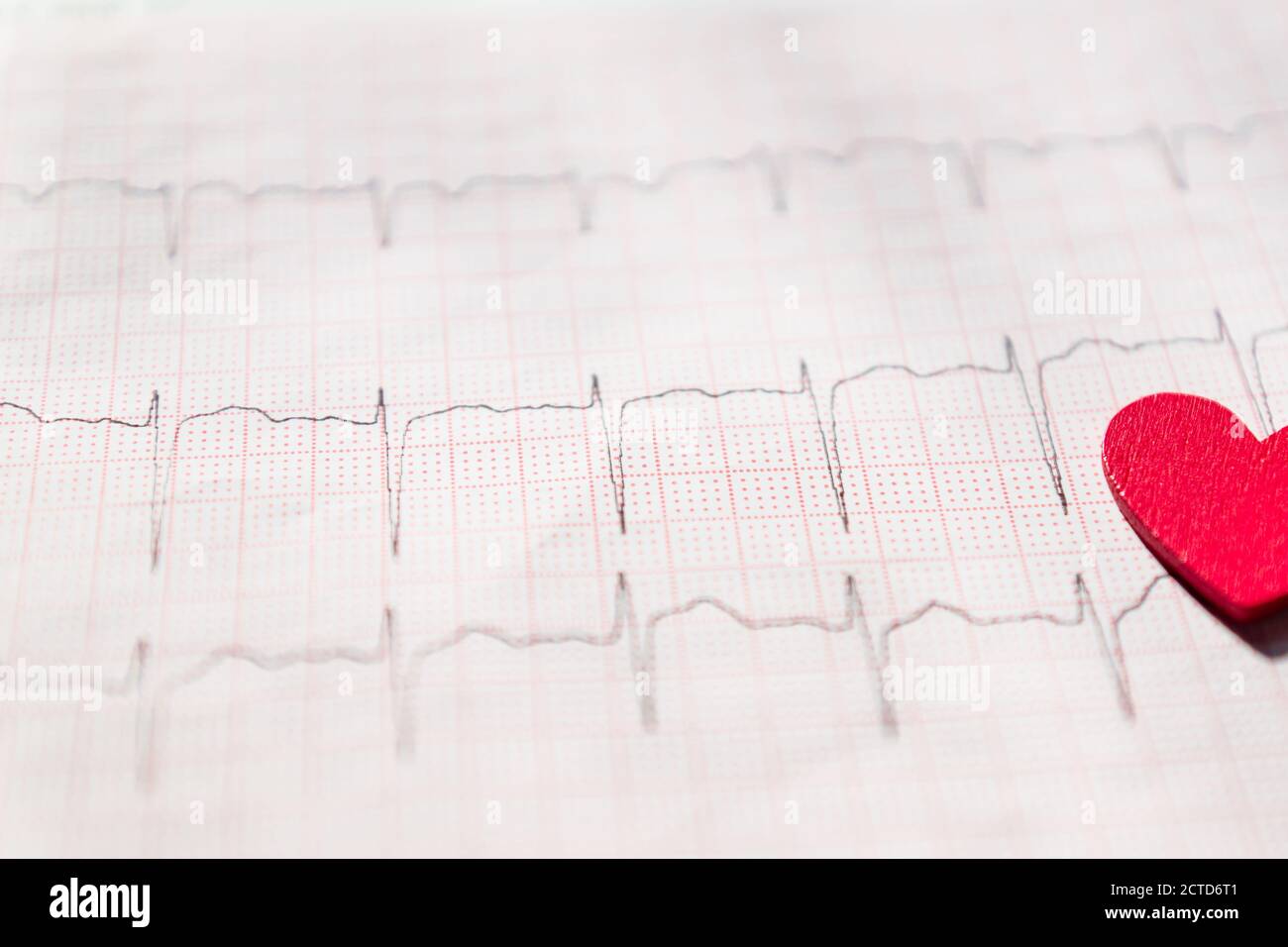 Ekg paper hi-res stock photography and images - Alamy