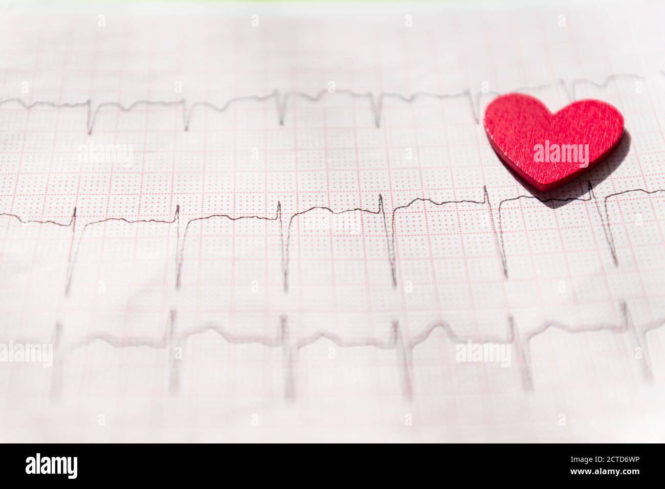 Normal heart rate cardiac ecg hi-res stock photography and images - Alamy