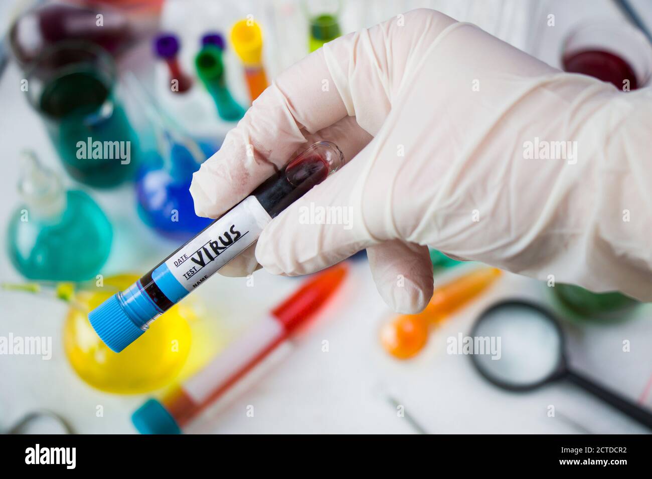 virus blood test tube in laboratory, glassware and reagents in lab ...