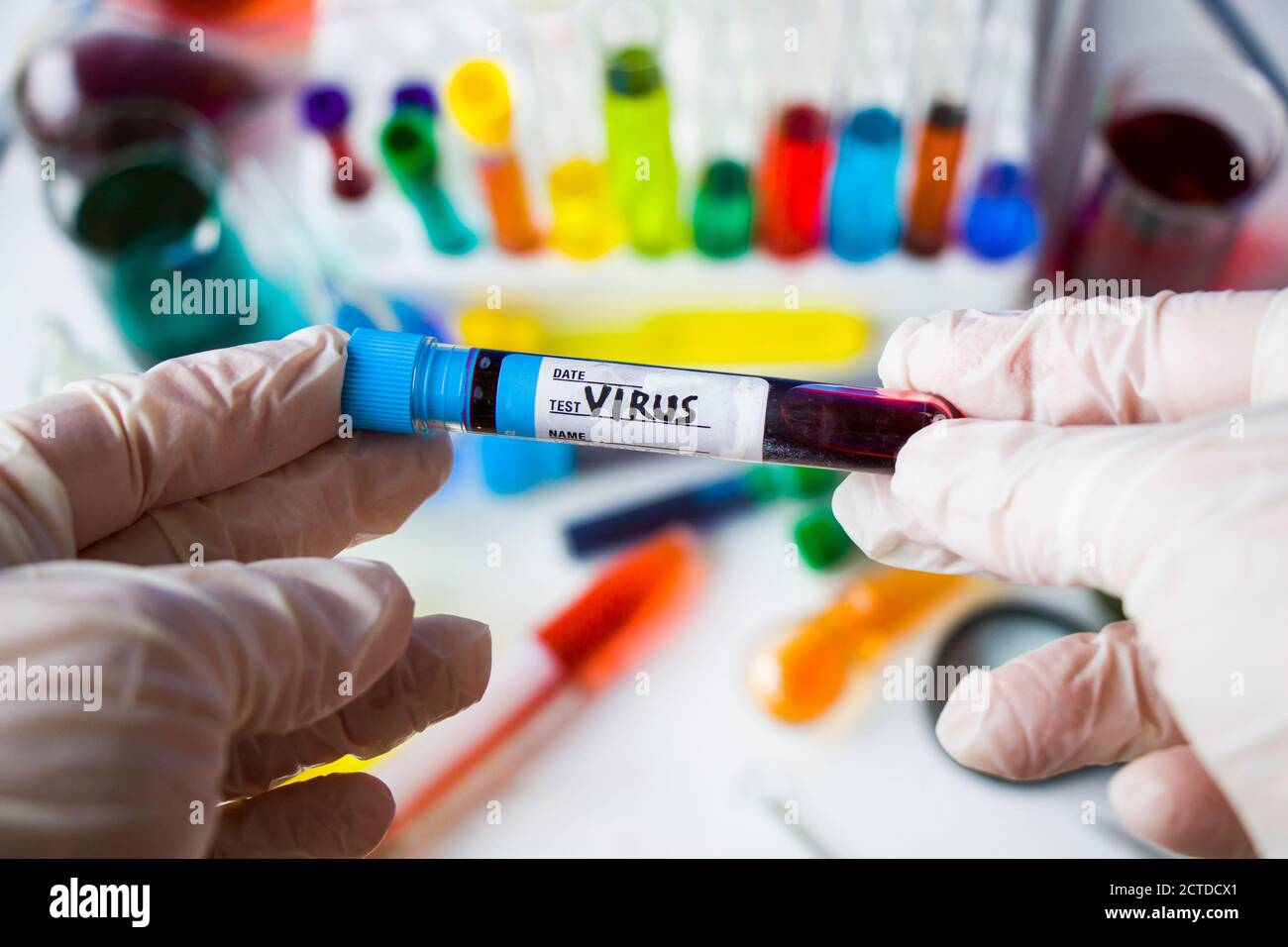 virus blood test tube in laboratory, glassware and reagents in lab ...