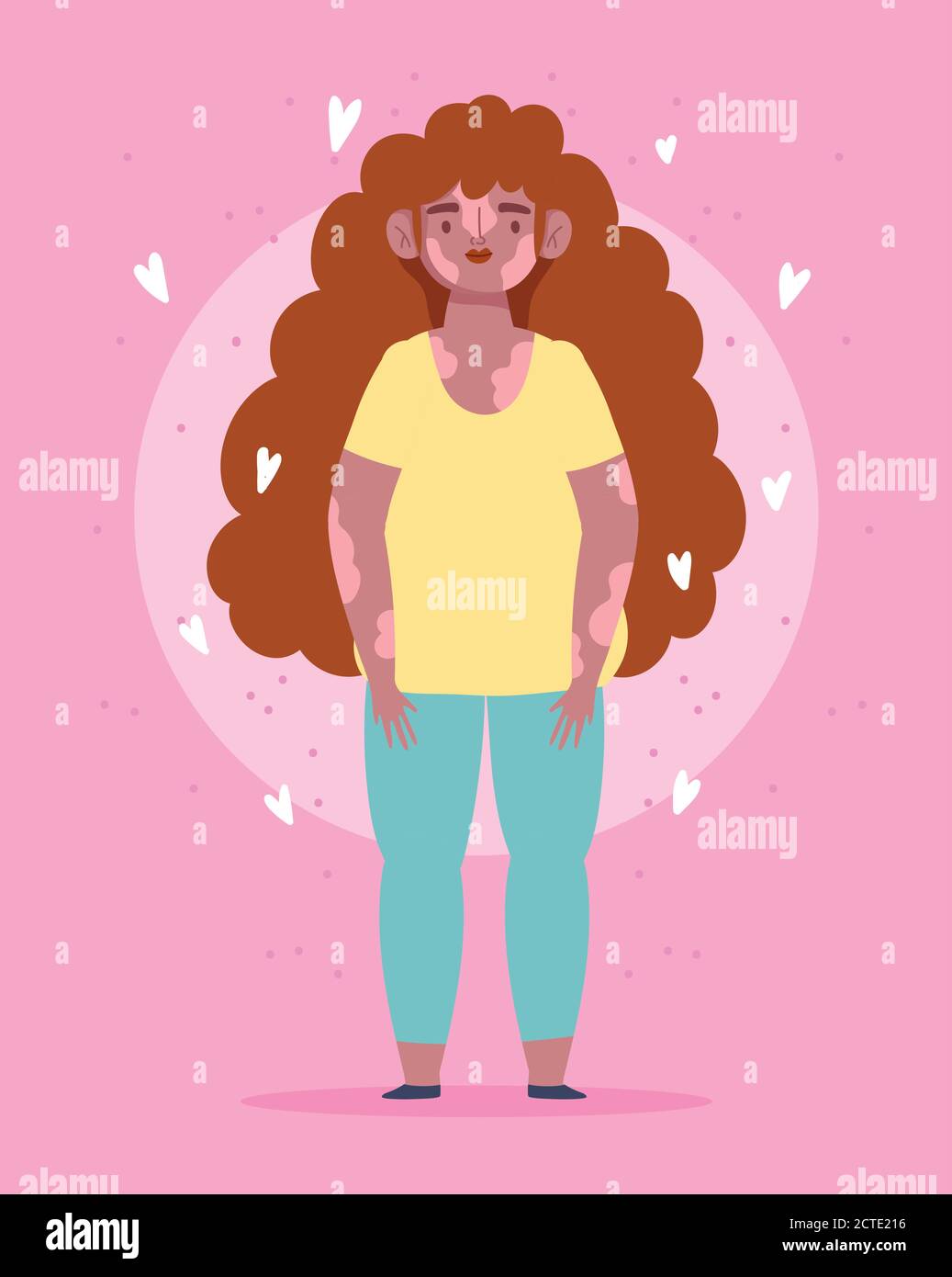 perfectly imperfect, cartoon woman standing with problem skin vector ...