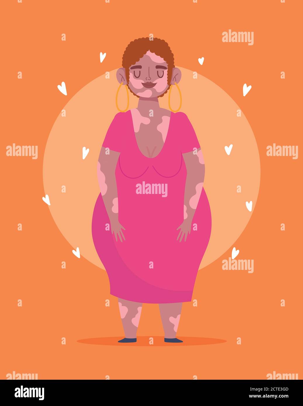 perfectly imperfect, plus size cartoon woman with vitiligo vector ...