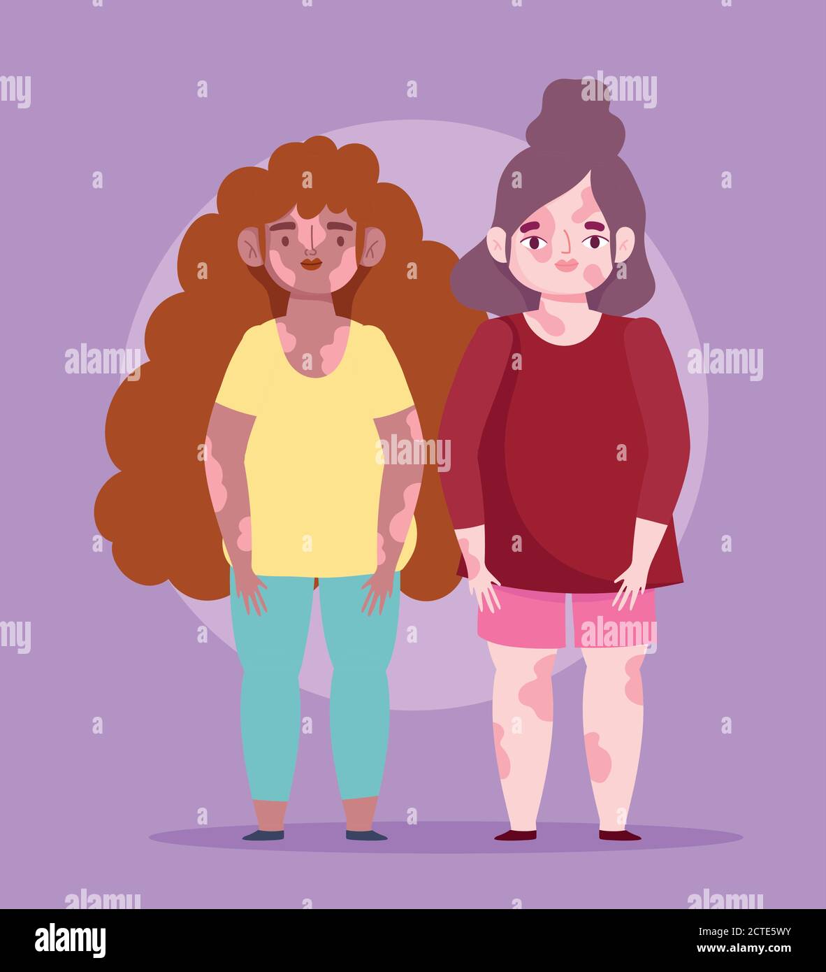 perfectly imperfect, young women cartoon with vitiligo disease skin ...