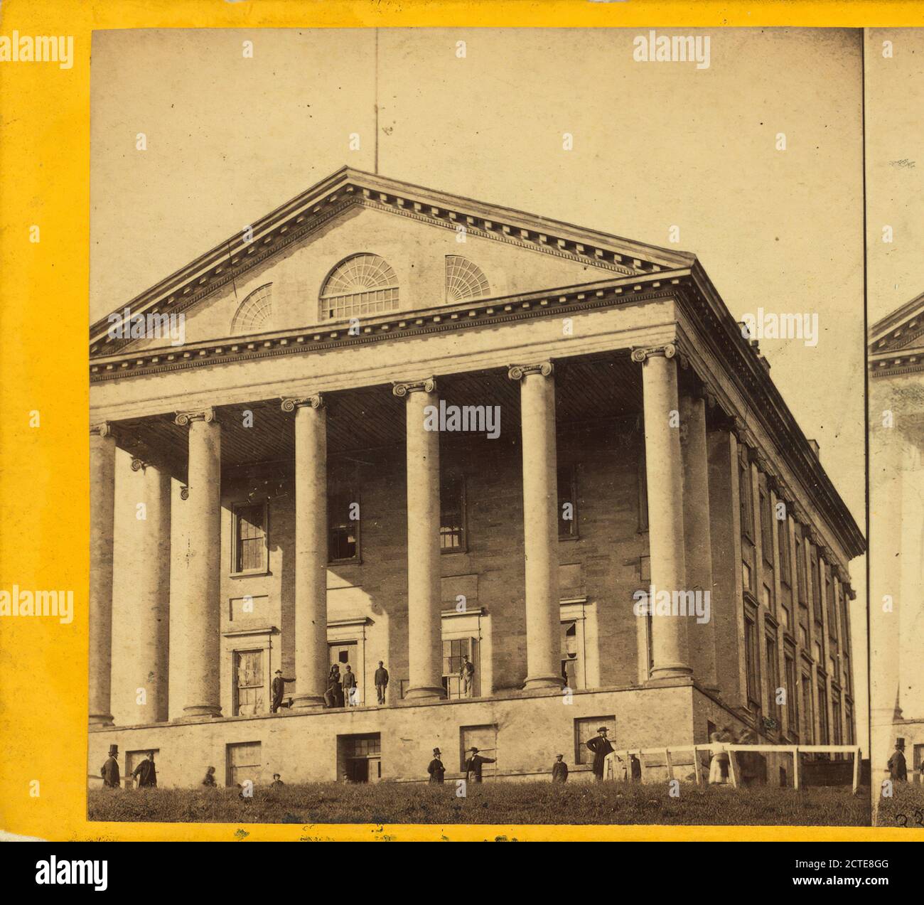 Anthony B So Many Things