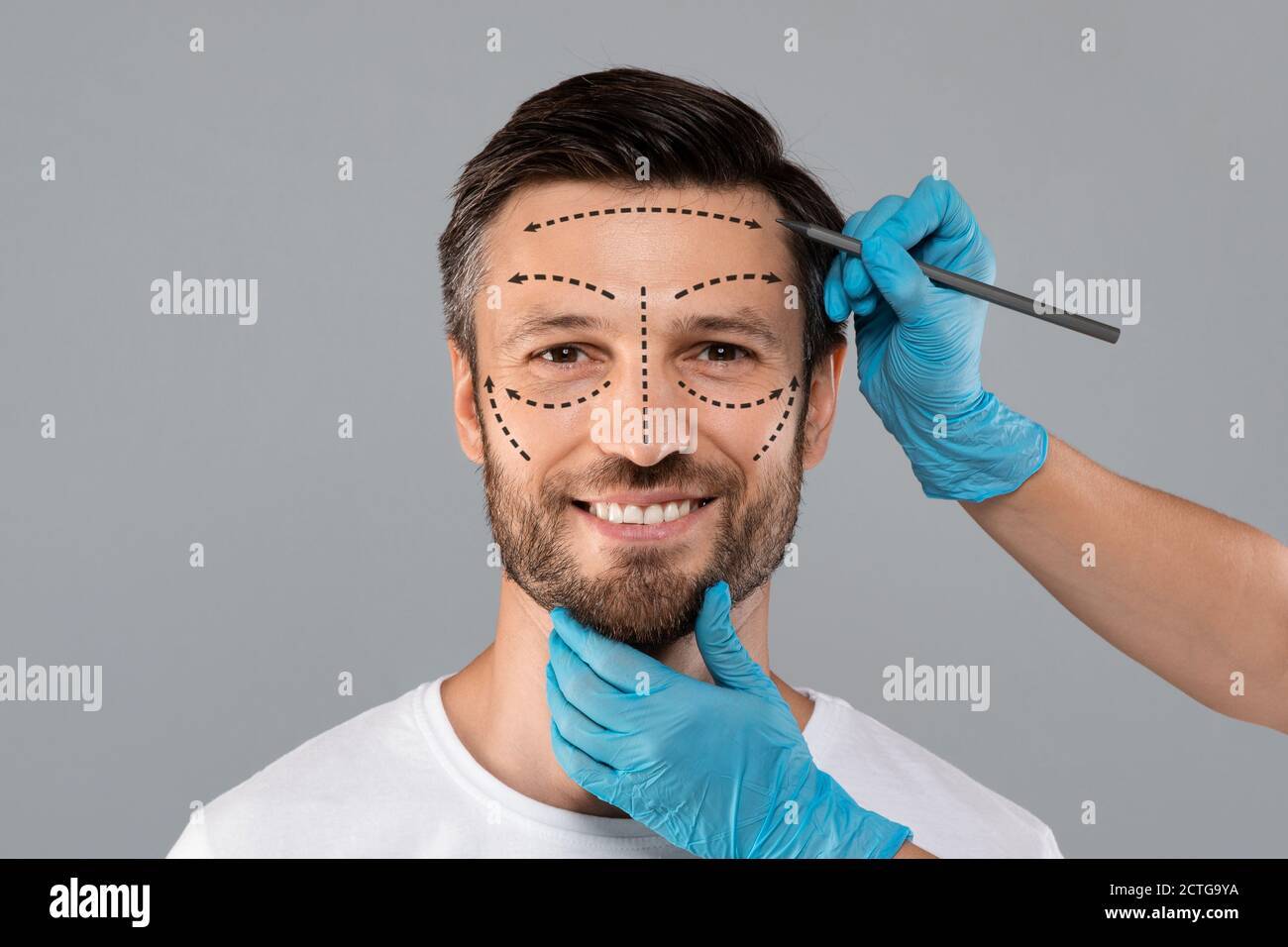 Surgeon hands making marks on smiling man face Stock Photo - Alamy