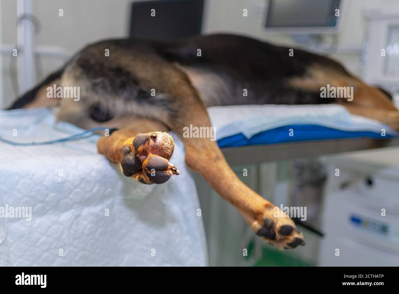 Sarcoma leg hi-res stock photography and images - Alamy