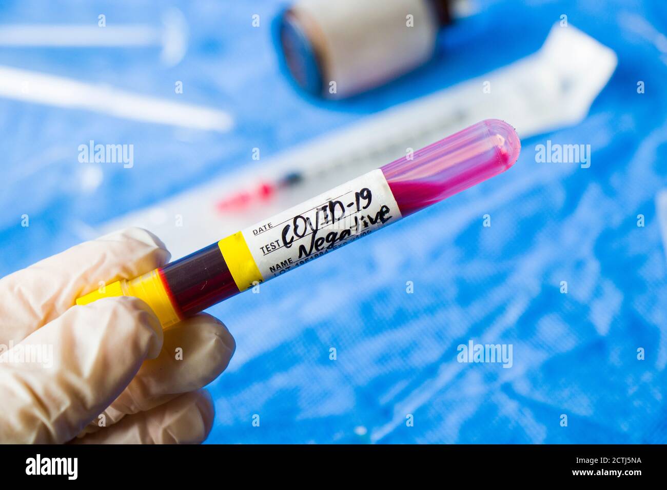 Corona virus negative blood test tubes on the white background, studio ...