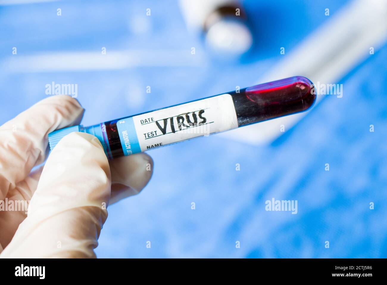 virus blood test tube in laboratory, glassware and reagents in lab ...