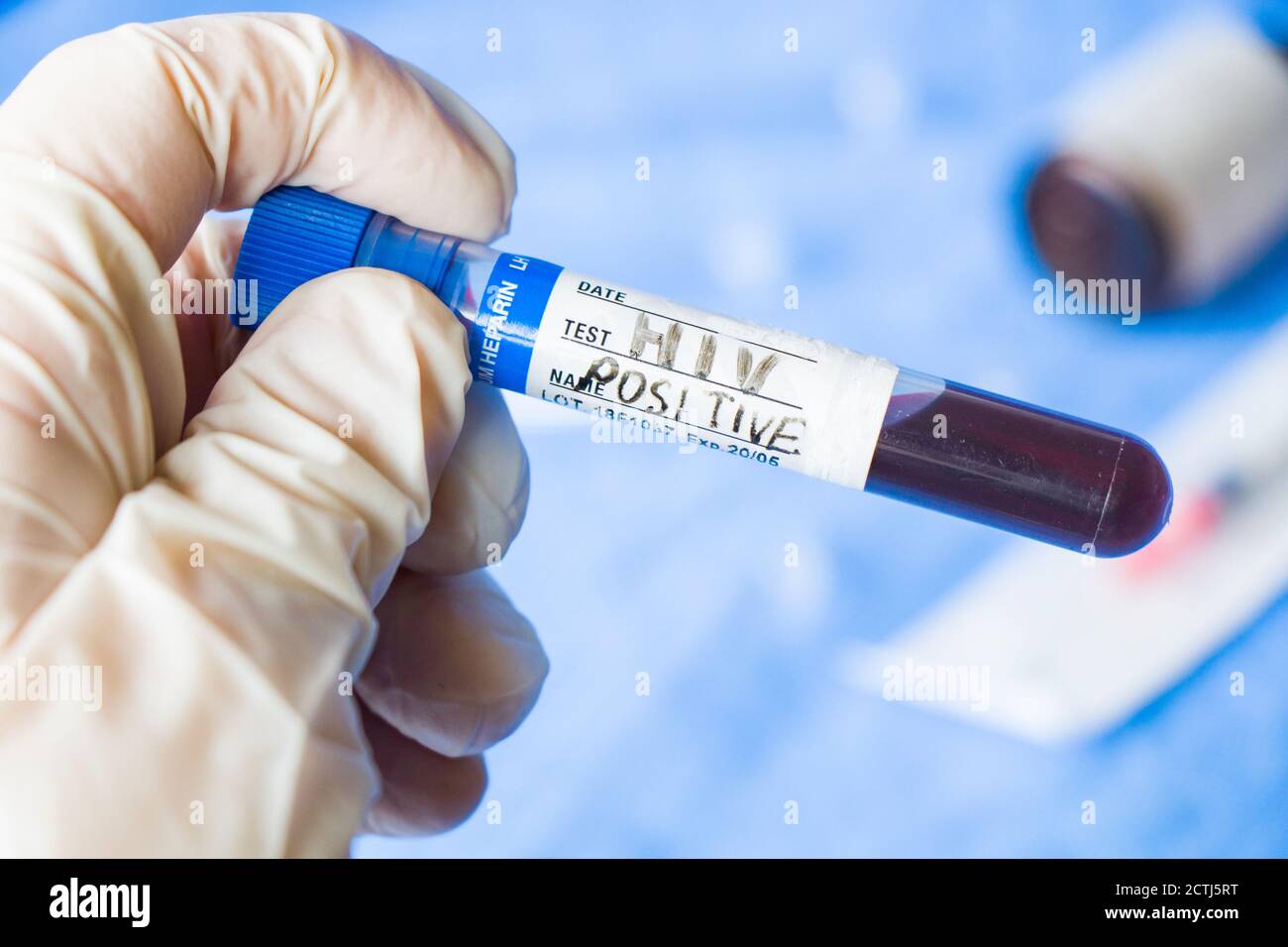 Hiv and aids infection test, hand holding tube with blood on the blue ...