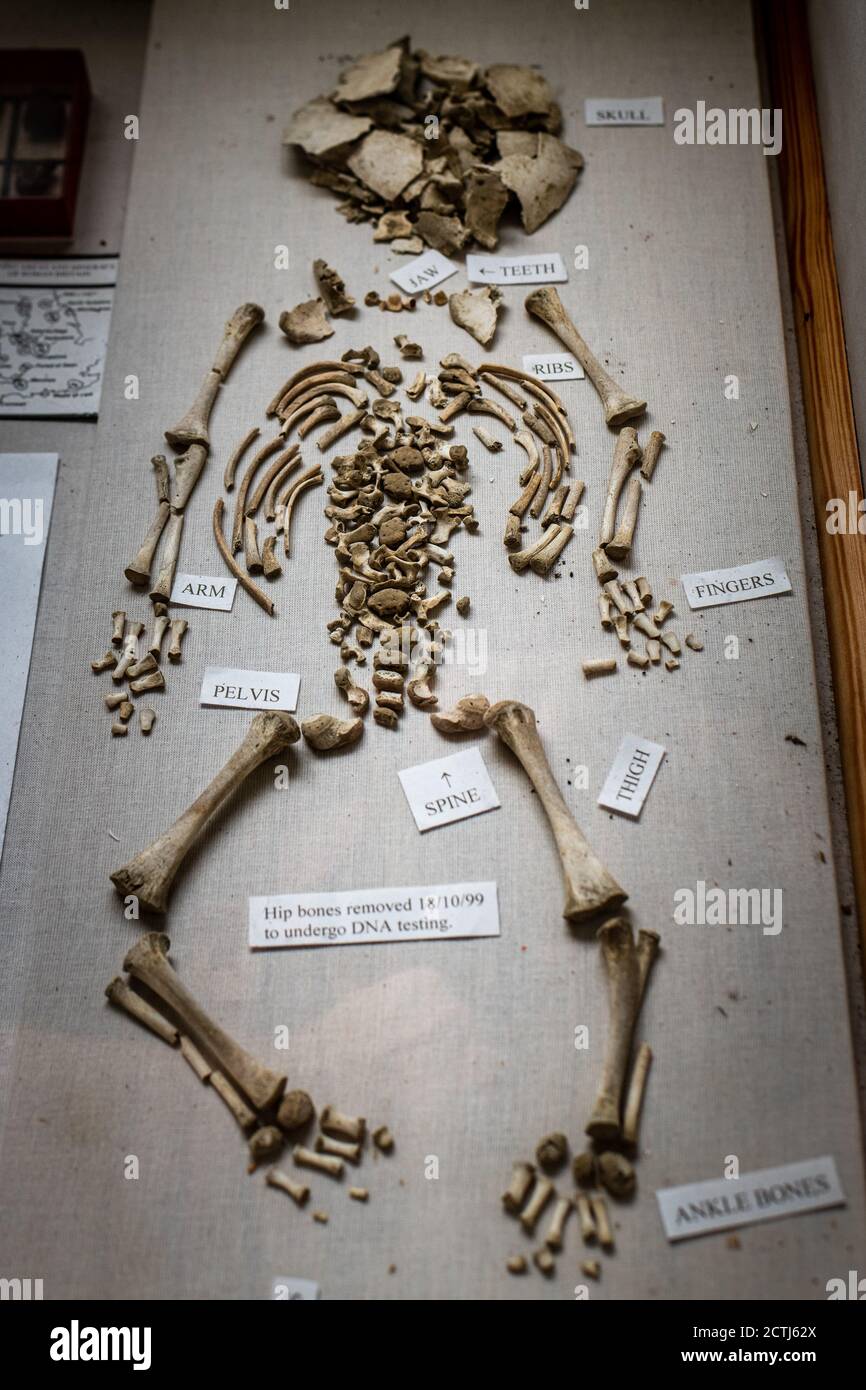 Caylee Anthony Skull Pictures Unblurred