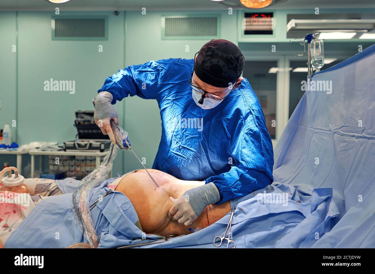 Team surgeon at work in operating room Stock Photo - Alamy