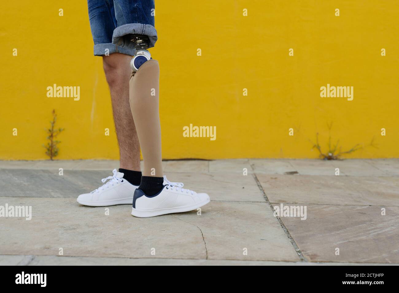 Male amputee hi-res stock photography and images - Alamy