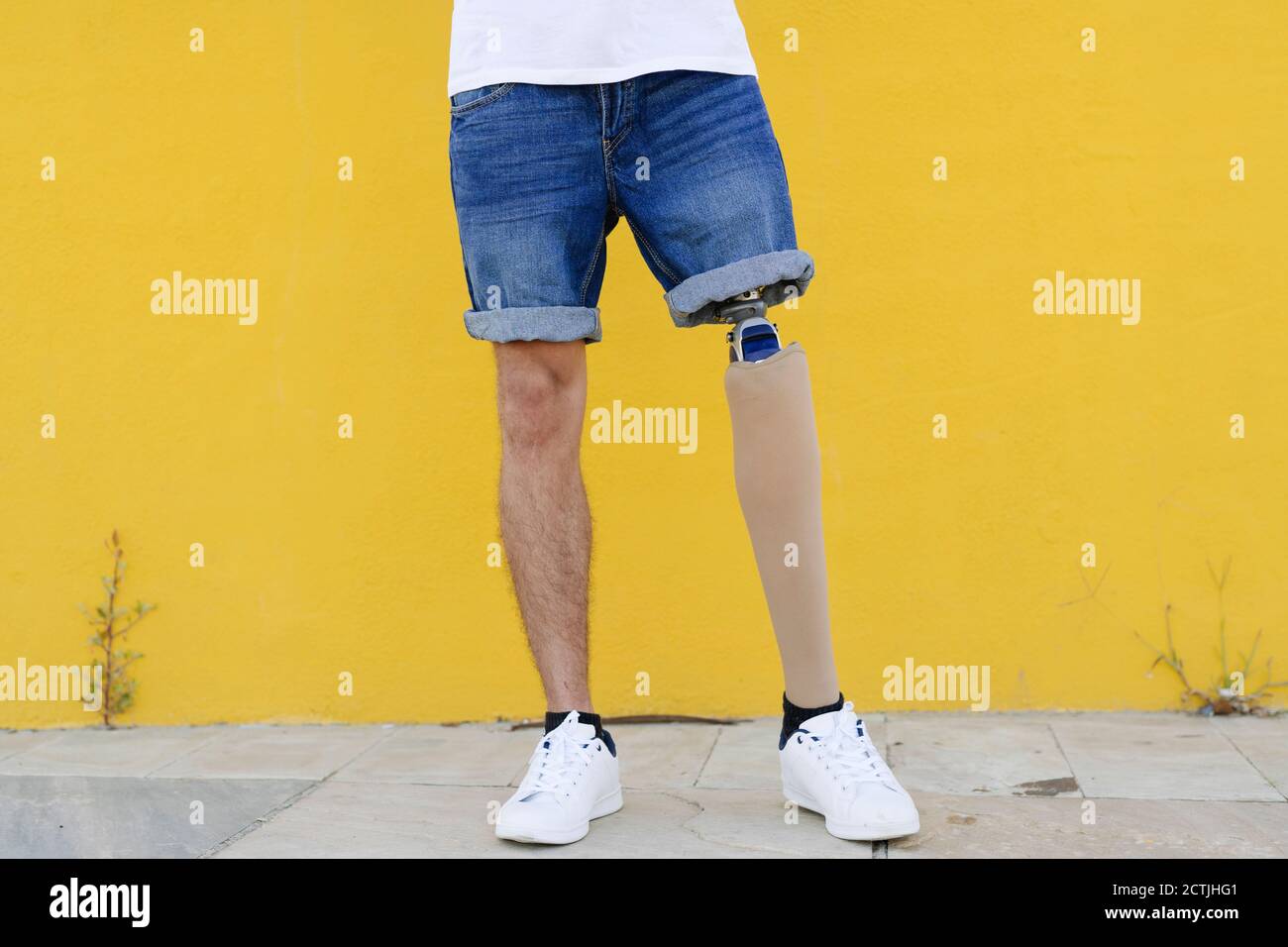 Handicapped male with leg prosthesis in sneakers standing near wall ...