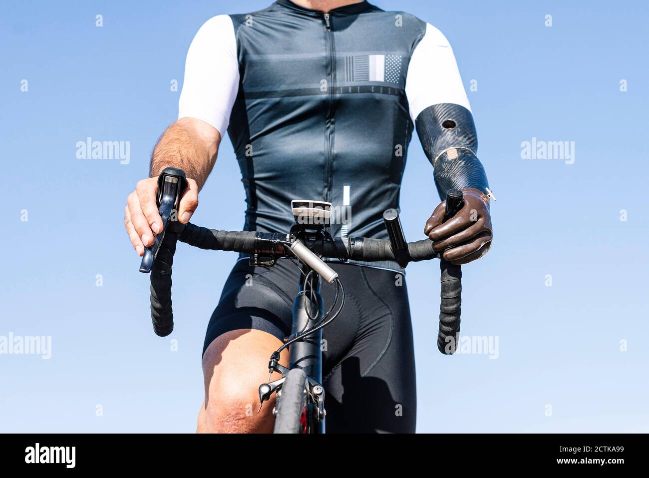 Hand amputee hi-res stock photography and images - Alamy