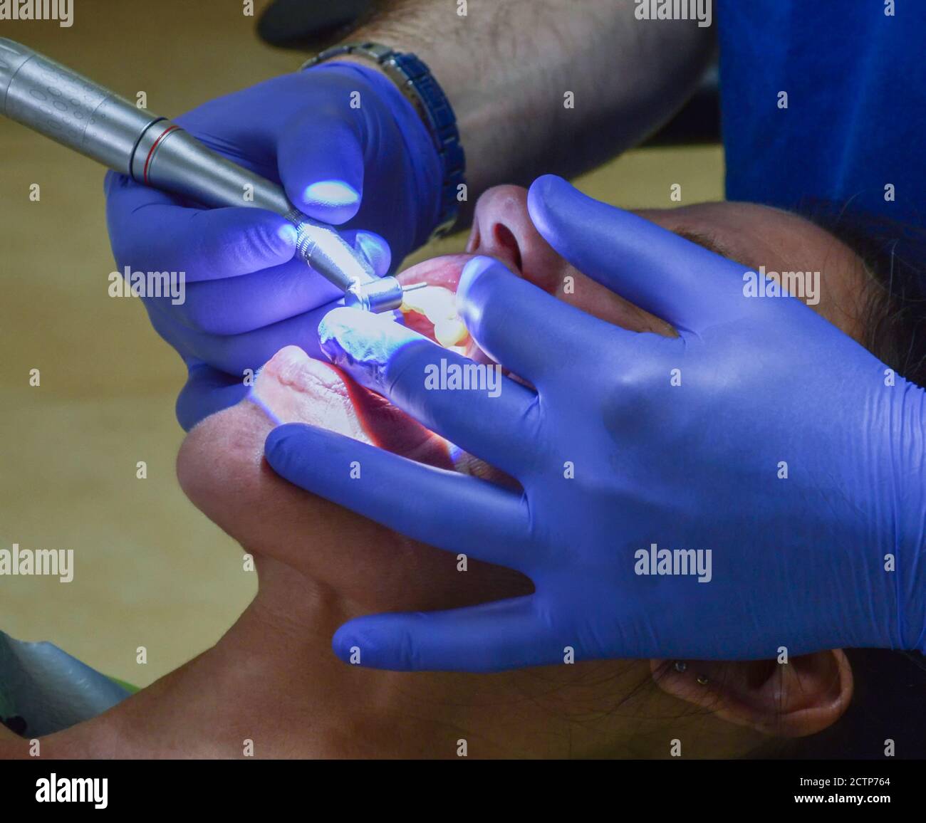 Open mouth during dental examination in a clinic Stock Photo - Alamy