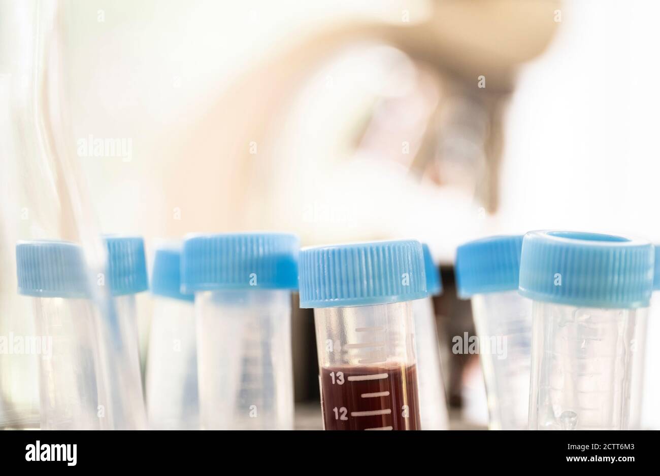 Chemistry laboratory experiment hi-res stock photography and images - Alamy