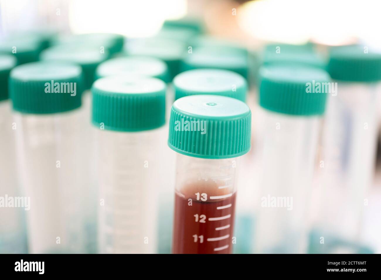 Laboratory scientific experiment hi-res stock photography and images ...