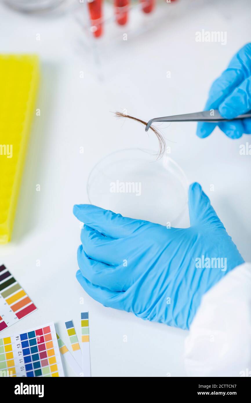 Test tube tongs gloves hi-res stock photography and images - Alamy