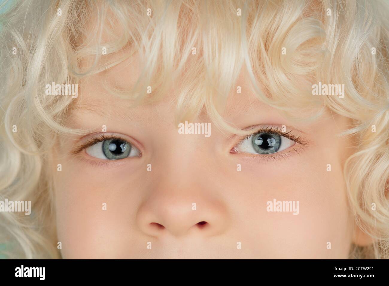 Caucasian Albino Eyes