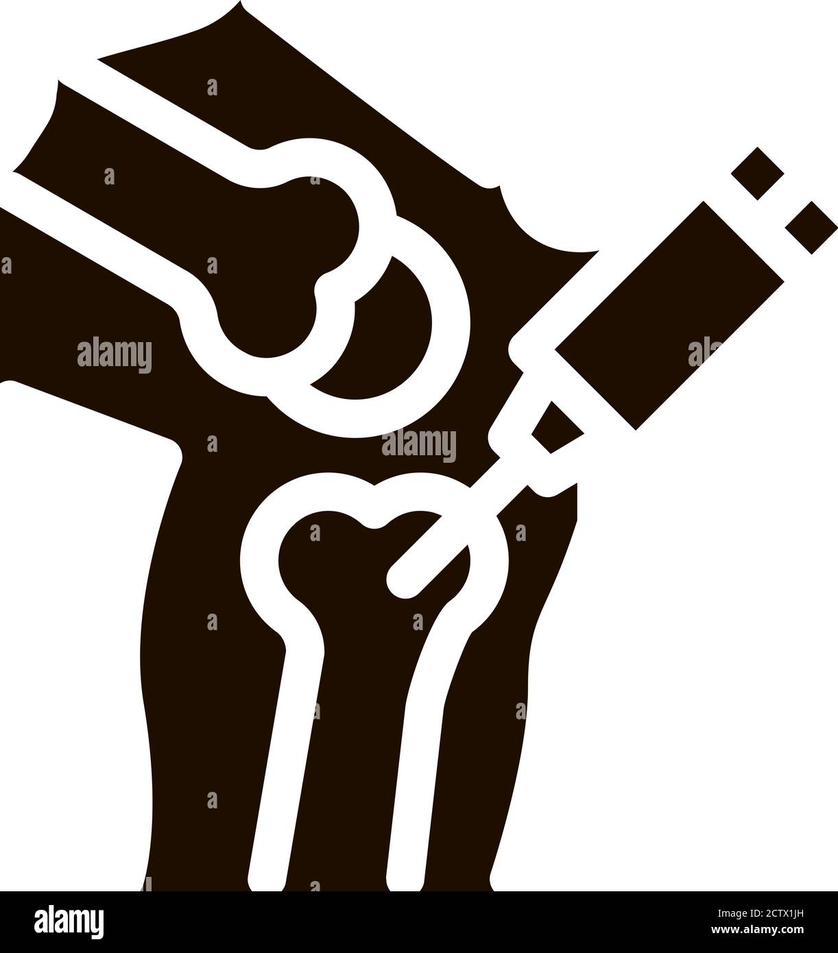 Orthopedic injection Stock Vector Images - Alamy